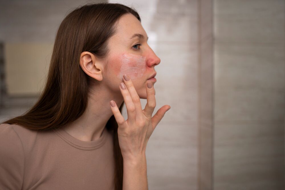 How Can Smooth Skin Be Rebuilt After Years of Inflammatory Damage ...